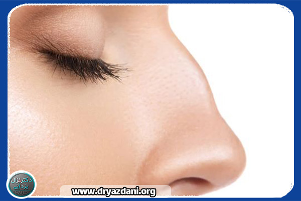 آیا برداشتن قوز بینی بدون جراحی امکان پذیر است ؟ 🤷 - دکتر غزال یزدانی